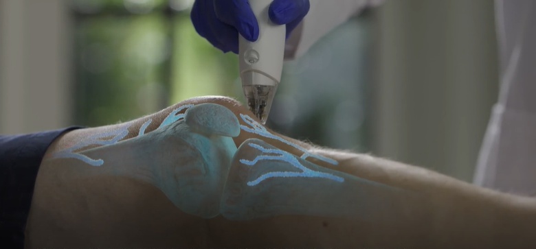 iovera°: A Game-Changer in Pain Relief for Osteoarthritis - VEGAS INC