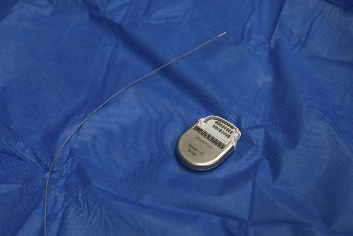 A pacemaker for the brain helped a woman with crippling depression. It ...